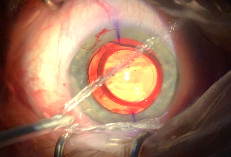 User Insight: RoboTip G2 shows off extremely resilient marks despite 2 ...